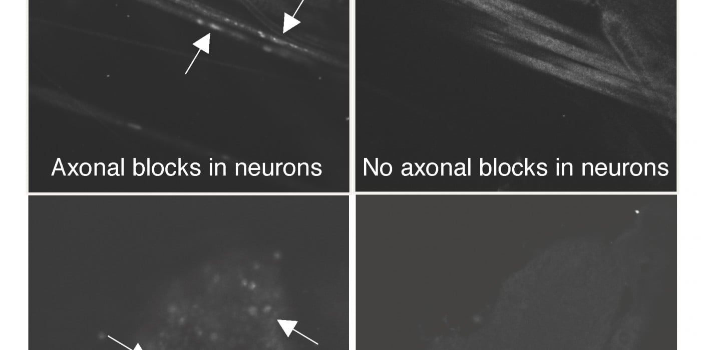 Neuroscience News Research Articles - Page 1394 of 1414