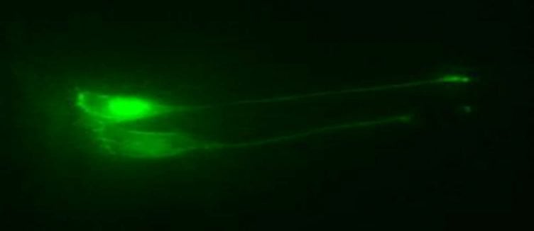 Researchers Uncover Secrets of Newborn Neurons - Neuroscience News