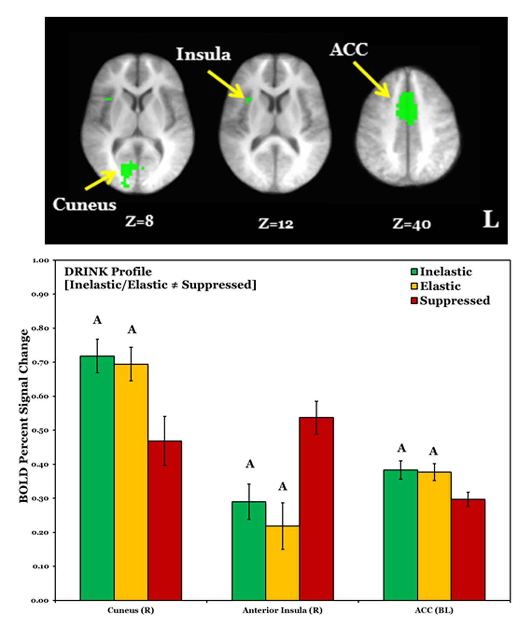 Researchers Study Decision Making Center of Brain - Neuroscience News