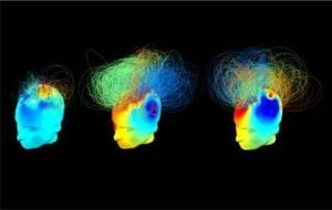 Scientists Find 'Hidden Brain Signatures' of Consciousness in ...