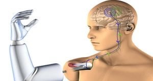Study Puts More Natural Movement for Artificial Limbs Within Reach ...