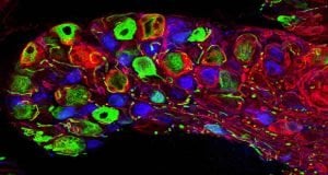 Stain Every Nerve - Neuroscience News
