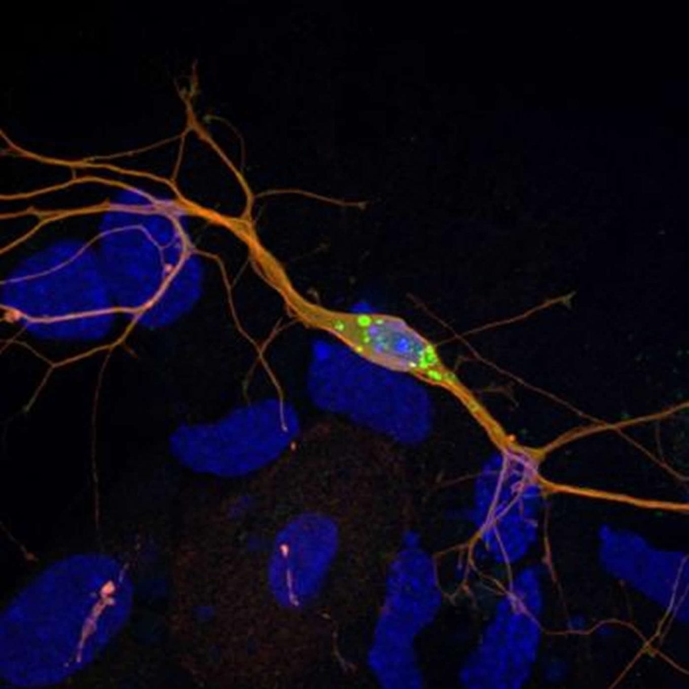 A Better Model for Parkinson's Disease - Neuroscience News