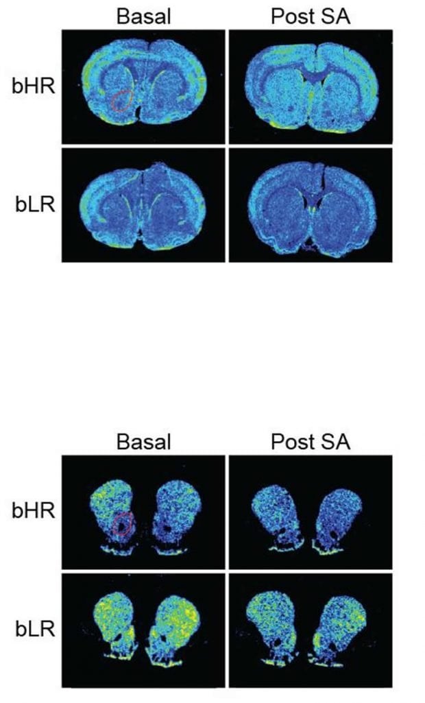 Genetic Markers That Influence Addiction Identified - Neuroscience News