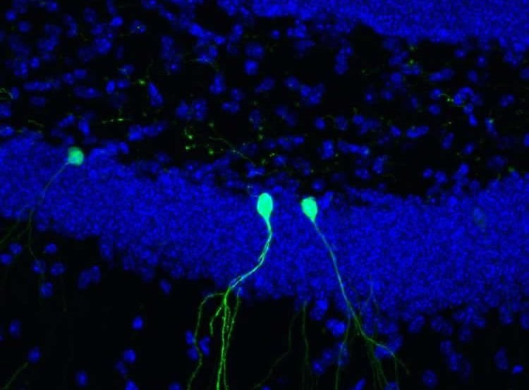 pruning News Research Tags Articles - Neuroscience News