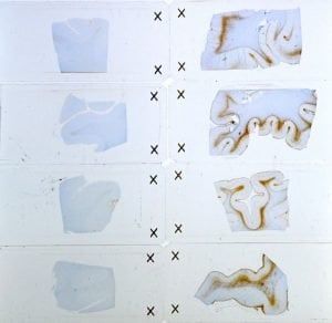 Invisible Wounds of War Now Able to be Seen - Neuroscience News