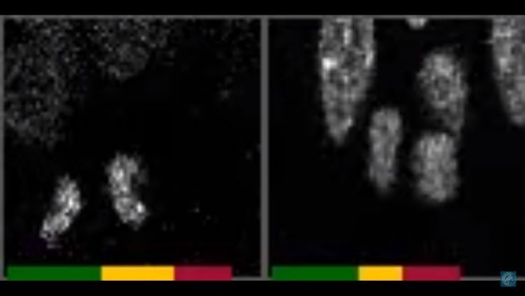 Differing Division Rates of Brain Stem Cells - Neuroscience News