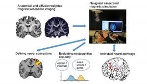 Magnetic Stimulation Improves Awareness of Cognitive Abilities ...