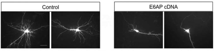Autism Linked Gene Stunts Developing Dendrites - Neuroscience News