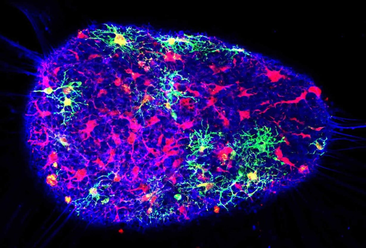 3D Mini Brains Accelerate Research for Repairing Brain Function ...