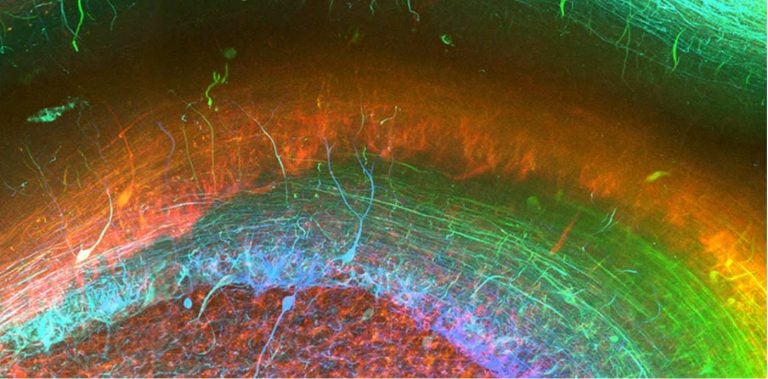 New Tissue Technique Gives Stunning 3D Insights Into the Human Brain ...