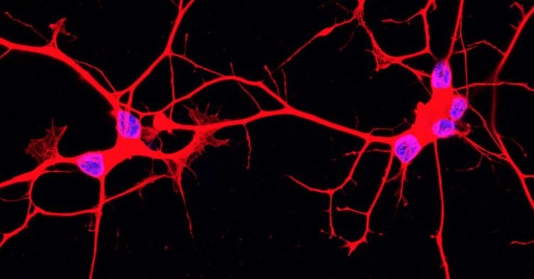 New Technique Helps Uncover Changes in ALS Neurons - Neuroscience News