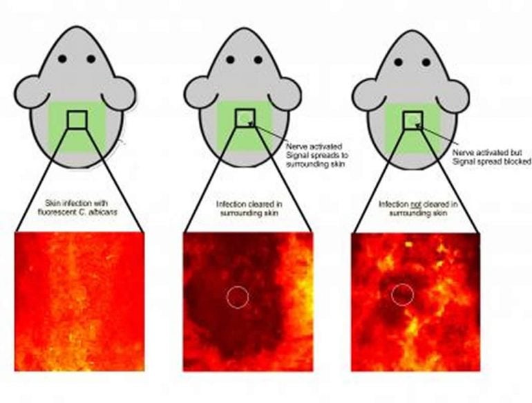 Skin nerves anticipate and fight infection: New type of immunity ...