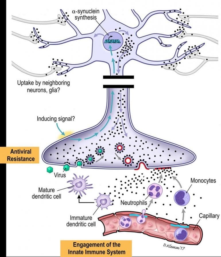 Targeting alpha-synuclein in the gut may slow down Parkinson's disease ...