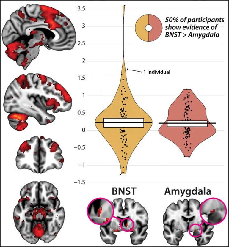 The Overlap Between Fear and Anxiety Brain Circuits - Neuroscience News