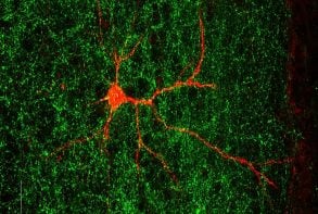 Autism-Linked Gene Found to Shape Nerve Connections - Neuroscience News