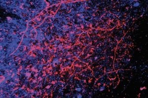 Origins of Pleasurable Touch Traced From Skin to Brain - Neuroscience News