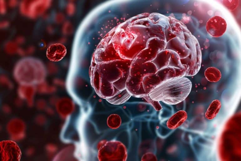 Brain Tumor Invasion Along Blood Vessels May Lead To New Cancer