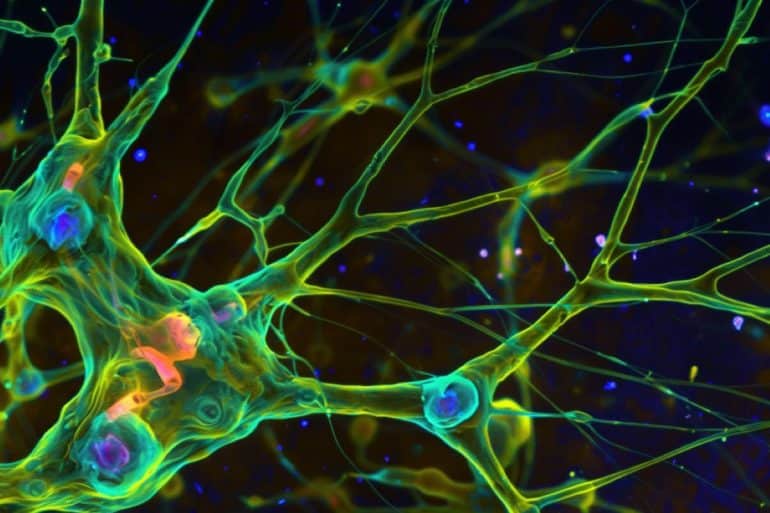Glial Cells Reprogrammed to Neurons for Brain Repair - Neuroscience News