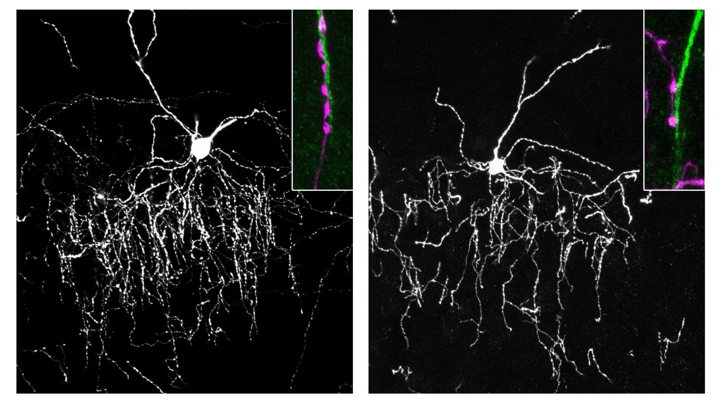 Brain Conductors Find Precise Connection to Target Cells via Protein ...