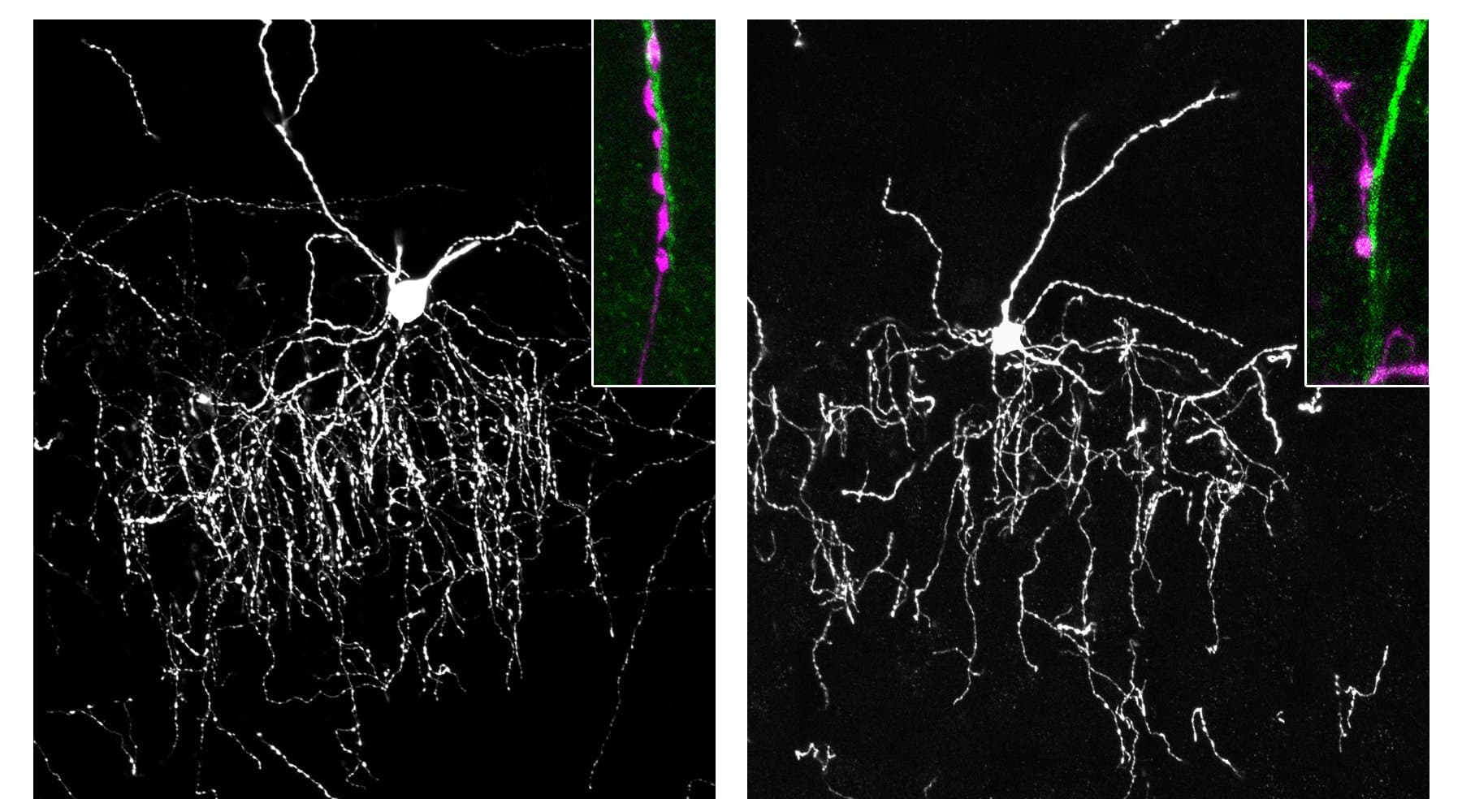 Brain Conductors Find Precise Connection to Target Cells via Protein ...