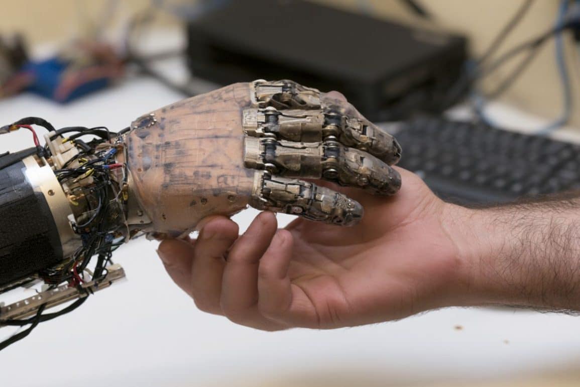 Dual Brain-Machine Interfaces Unlock Bionic Hand Kinesthesia ...