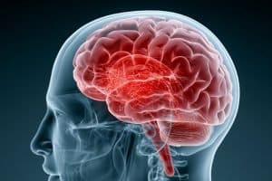 Concussions Convert Brain Stabilizers Into Disruptive Forces ...