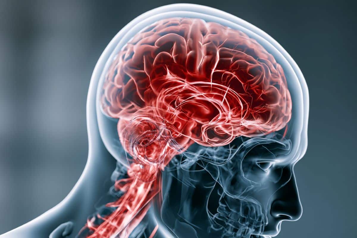 TBI and Common Neurological Conditions Accelerate One Another ...